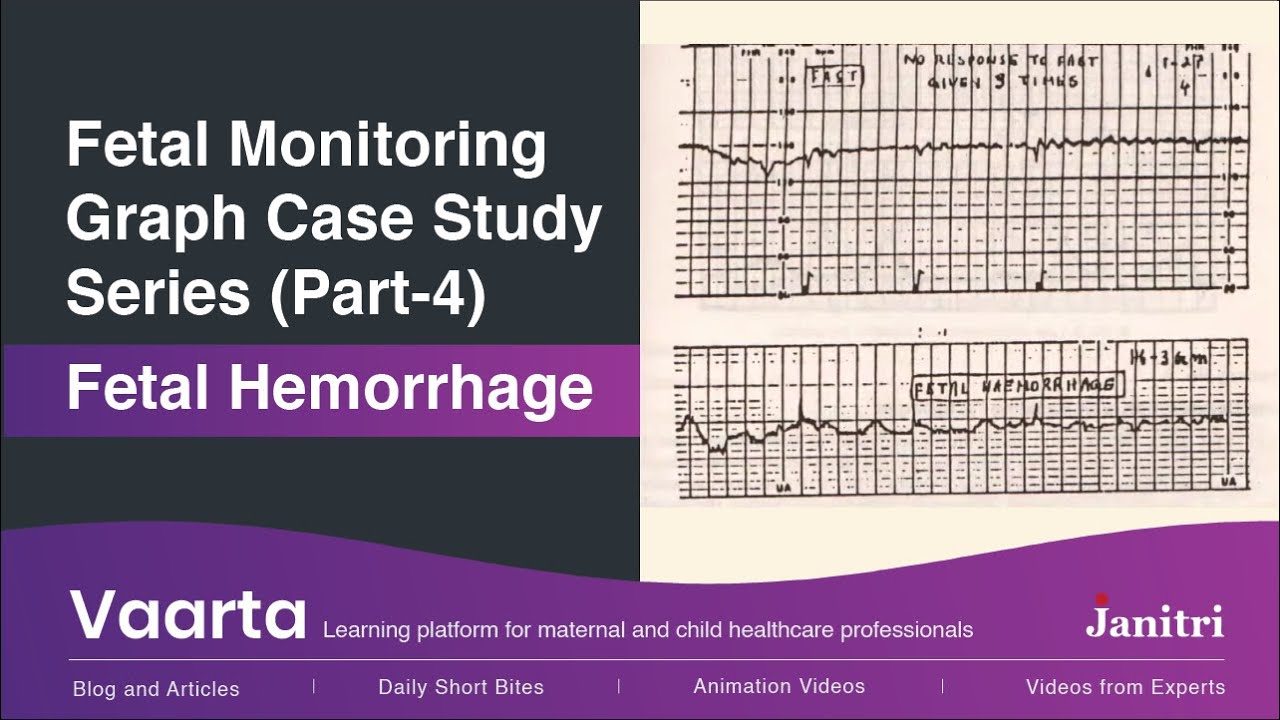 Fetal Monitoring Graph Case Study | Series | Part 4